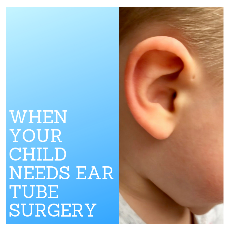 When your child needs ear tube surgery
